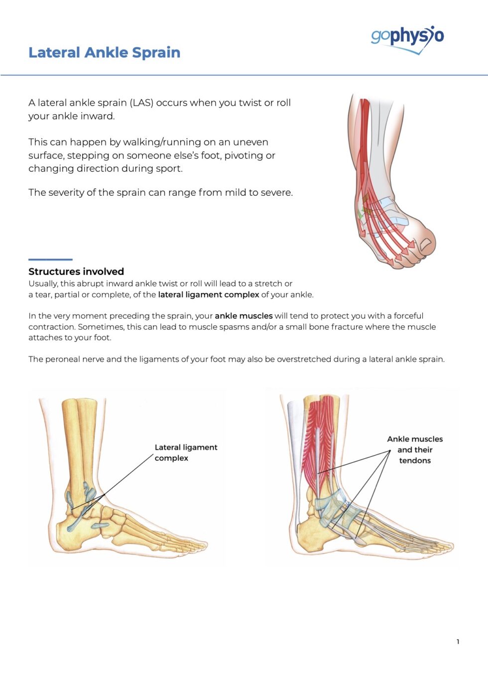 Injury Focus: Ankle Sprain | goPhysio